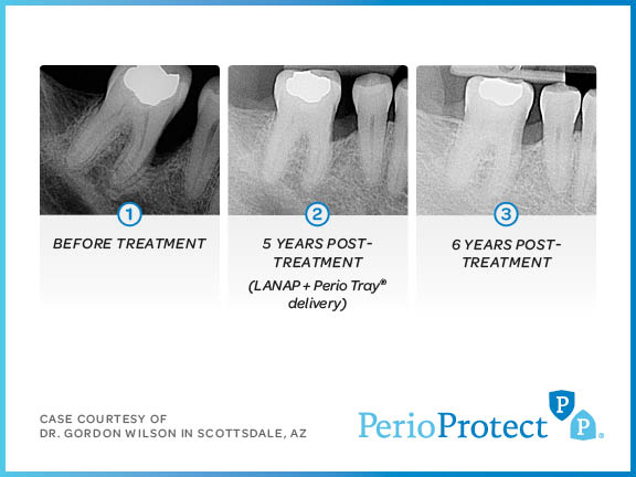 Media & Marketing Assets | Perio Protect for Providers